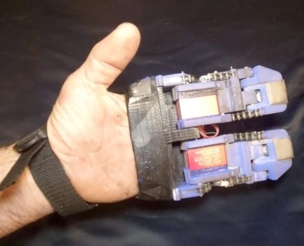 Ian Davis Shows Off His Two-Fingered, Ninja Turtle Hand Prosthetic ...