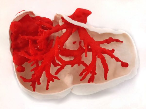 The Full Spectrum Of 3D Printed Surgical Models « Fabbaloo