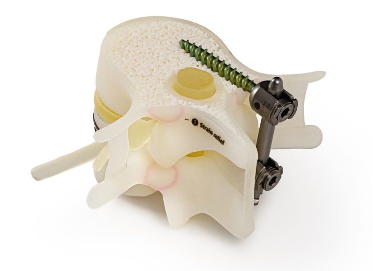 Stratasys Direct Now Offers Anatomical 3D Printing « Fabbaloo