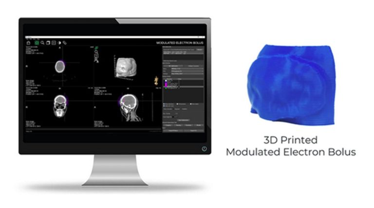 Combating Cancer: Exploring the Potential of HP, Varian and Adaptiiv's ...