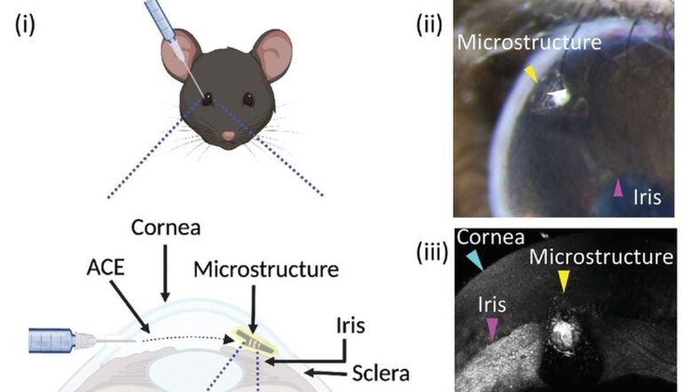Innovative 3D Printed Bio-Implants: A New Approach Using the Eye « Fabbaloo