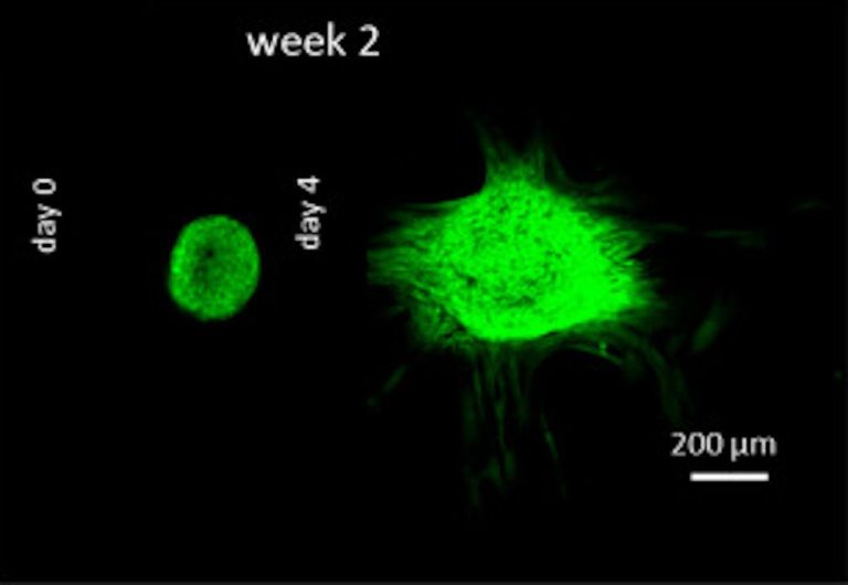 Innovative 3D Bioprinting Technique Paves Way for Engineering Human ...