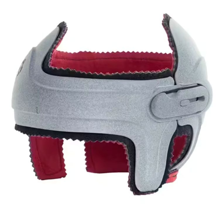 From Craft to Code: How Ottobock Industrialized Personalization « Fabbaloo